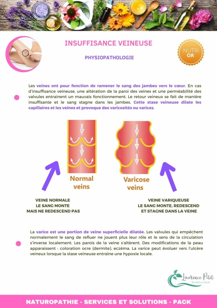 Insuffisance Veineuse Traitement Naturel – EYONM